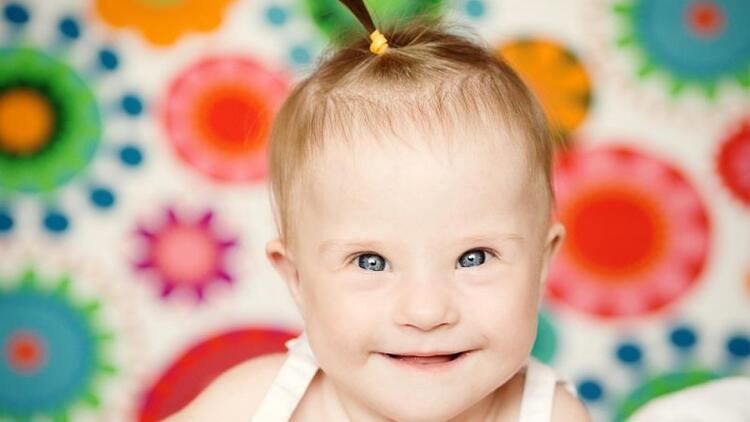 Down Sendromu Nedir, Çeşitleri Nelerdir? – Kidoveyn.com